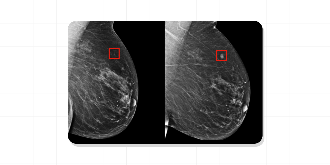 Top 15 Data Science Projects in Python [with Source Code]